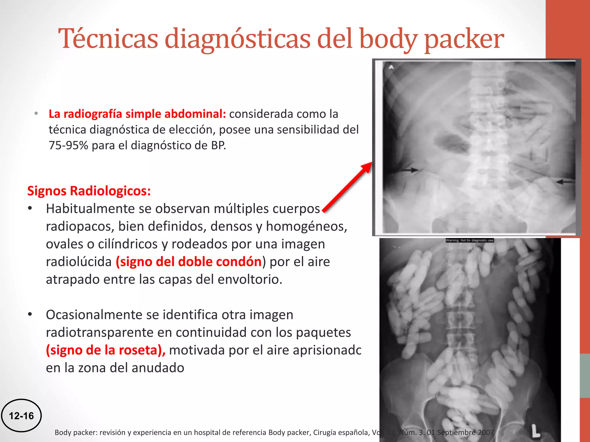 Body Packer | PPT