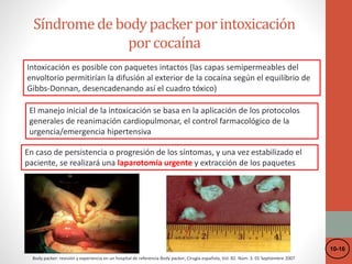 Body Packer | PPTX