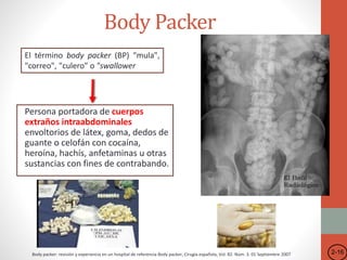 Body Packer | PPTX