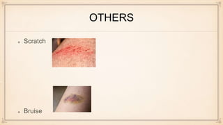 Body part and accidents.pptx