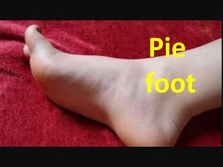 Body parts/ partes del cuerpo | PPTX