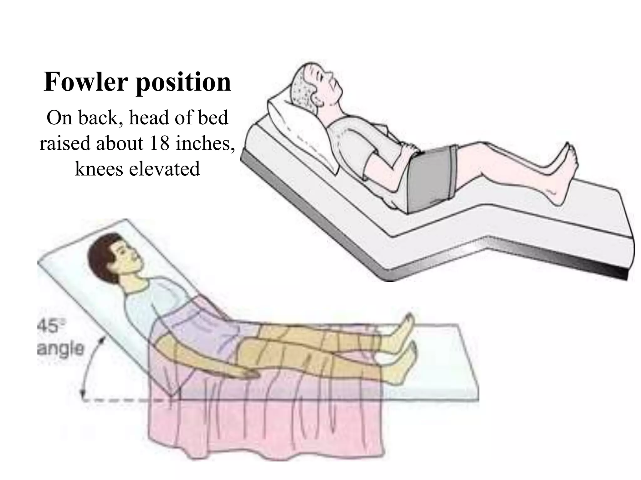 Medical Terminology - Body position | PPTX