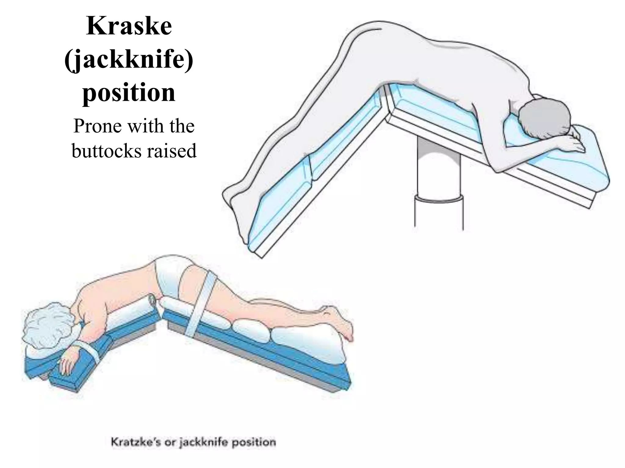 Medical Terminology - Body position | PPTX