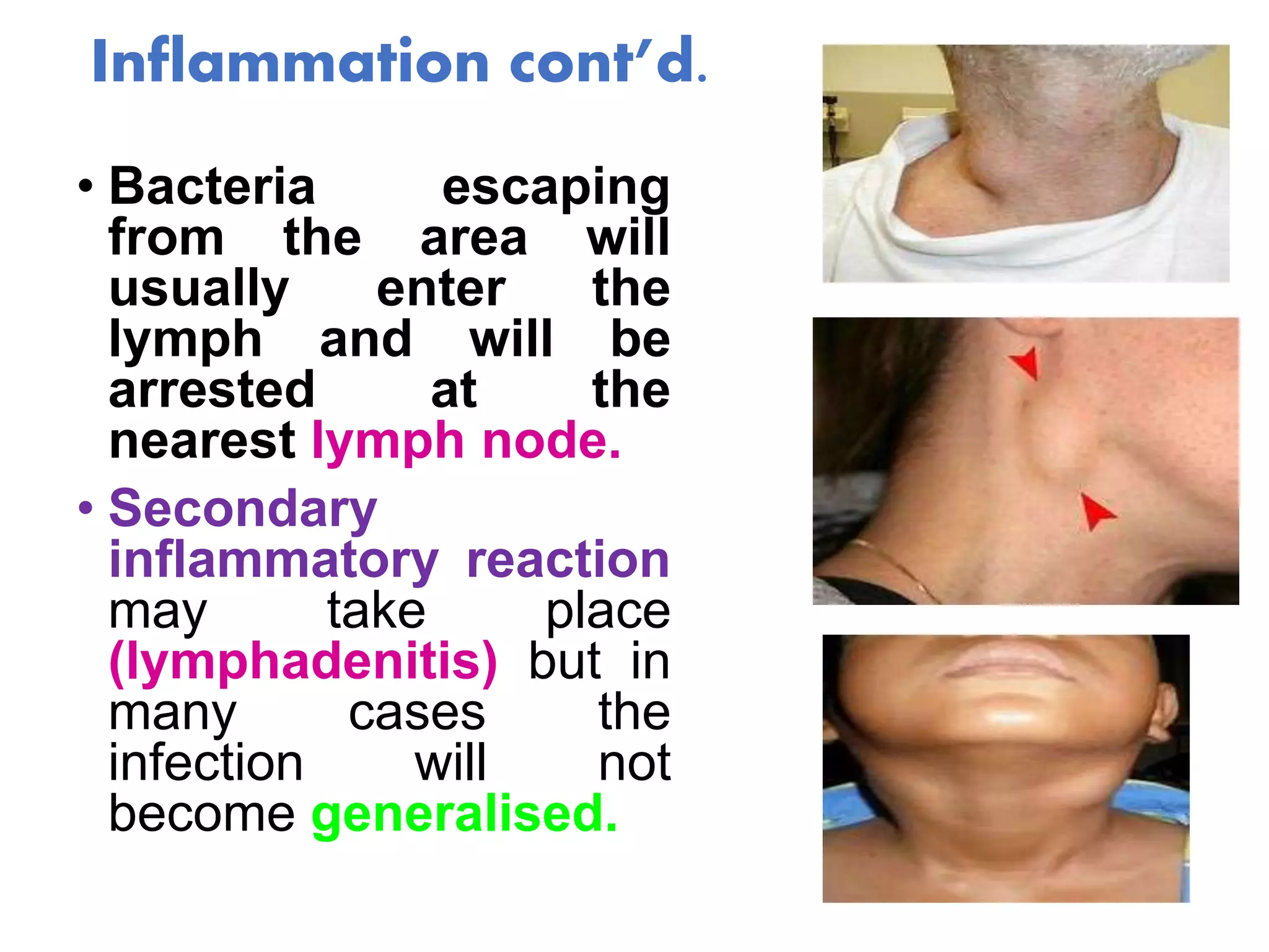BODY’S DEFENSE MECHANISMS.pptx