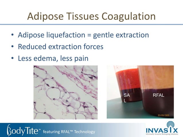 BodyTite™ of Invasix - Presentation | PPT