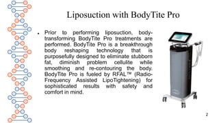 Bodytite Liposuction Cost in Bangkok, Thailand | PPTX | Skin and ...