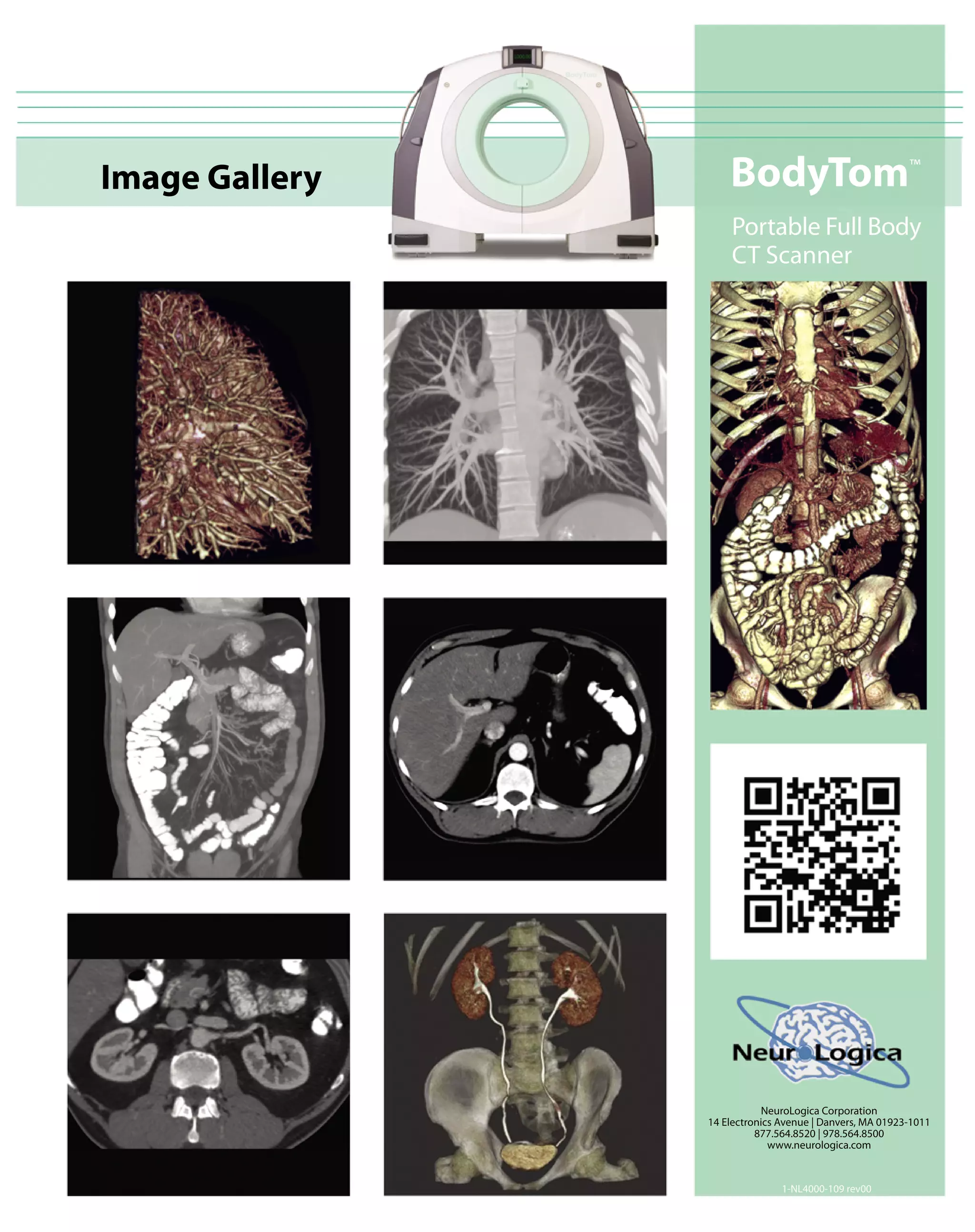 Body tom image gallery | PDF