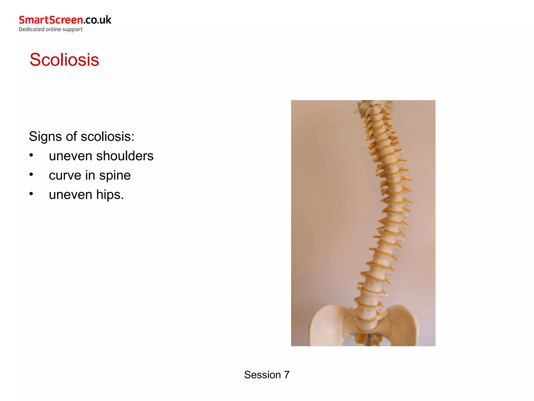 Body types and postural faults | PPT