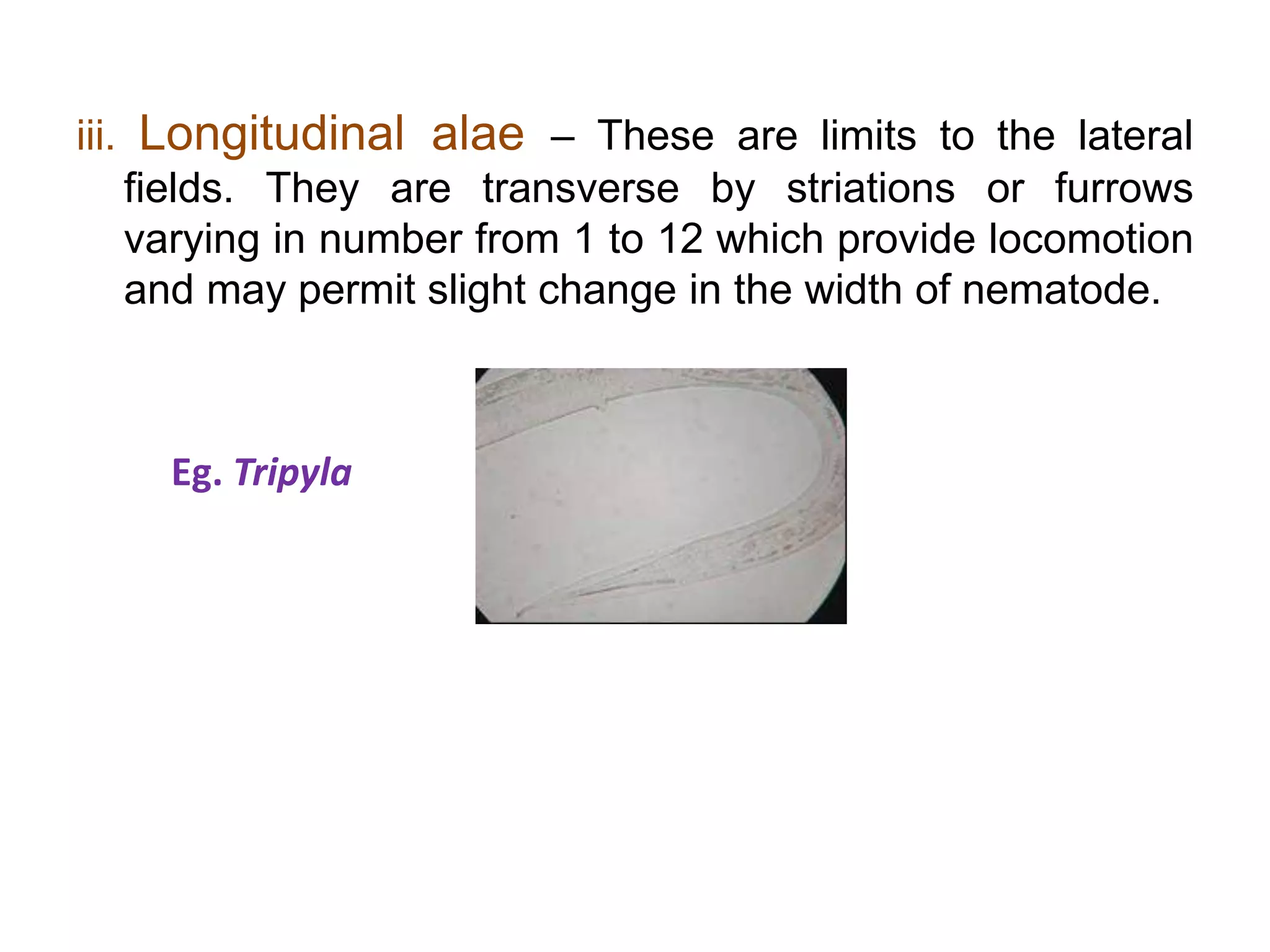 Body wall of nematode | PPTX