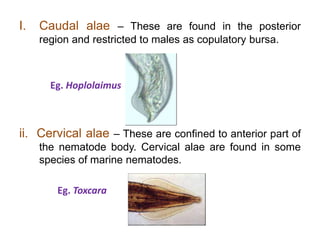 Body wall of nematode | PPTX