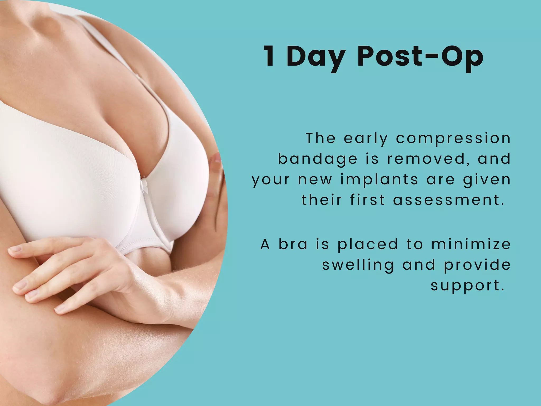 Breast Augmentation Timeline | PDF