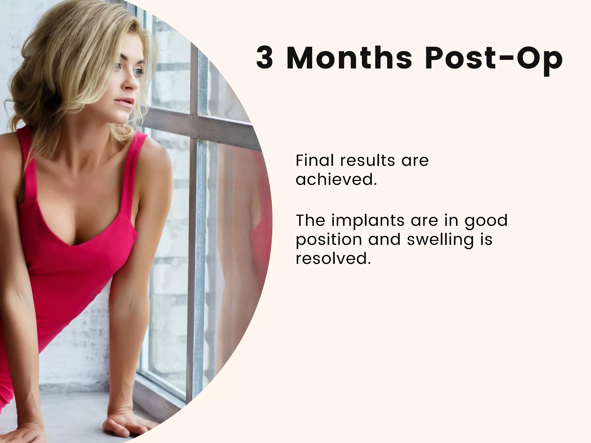 Breast Augmentation Timeline Ppt