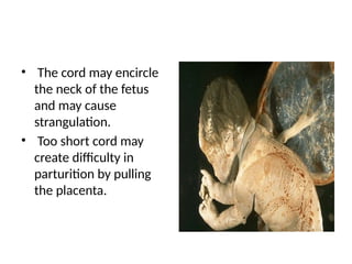 umblical_cord.pptx........................ | PPTX