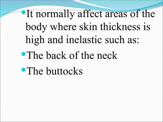 Nursing presentation on Boils and carbuncles.ppt