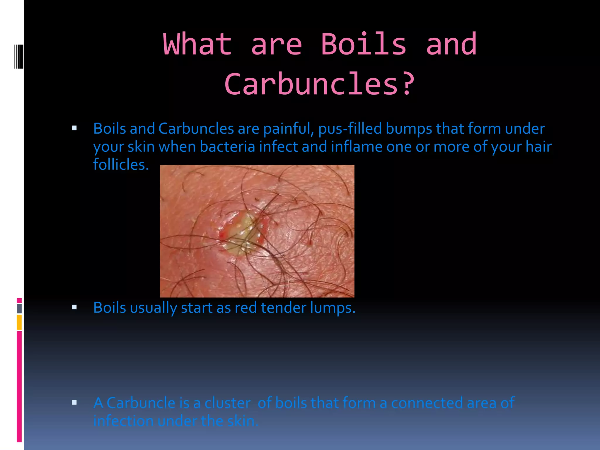 Boils And Carbuncles Powerpoint Ppt