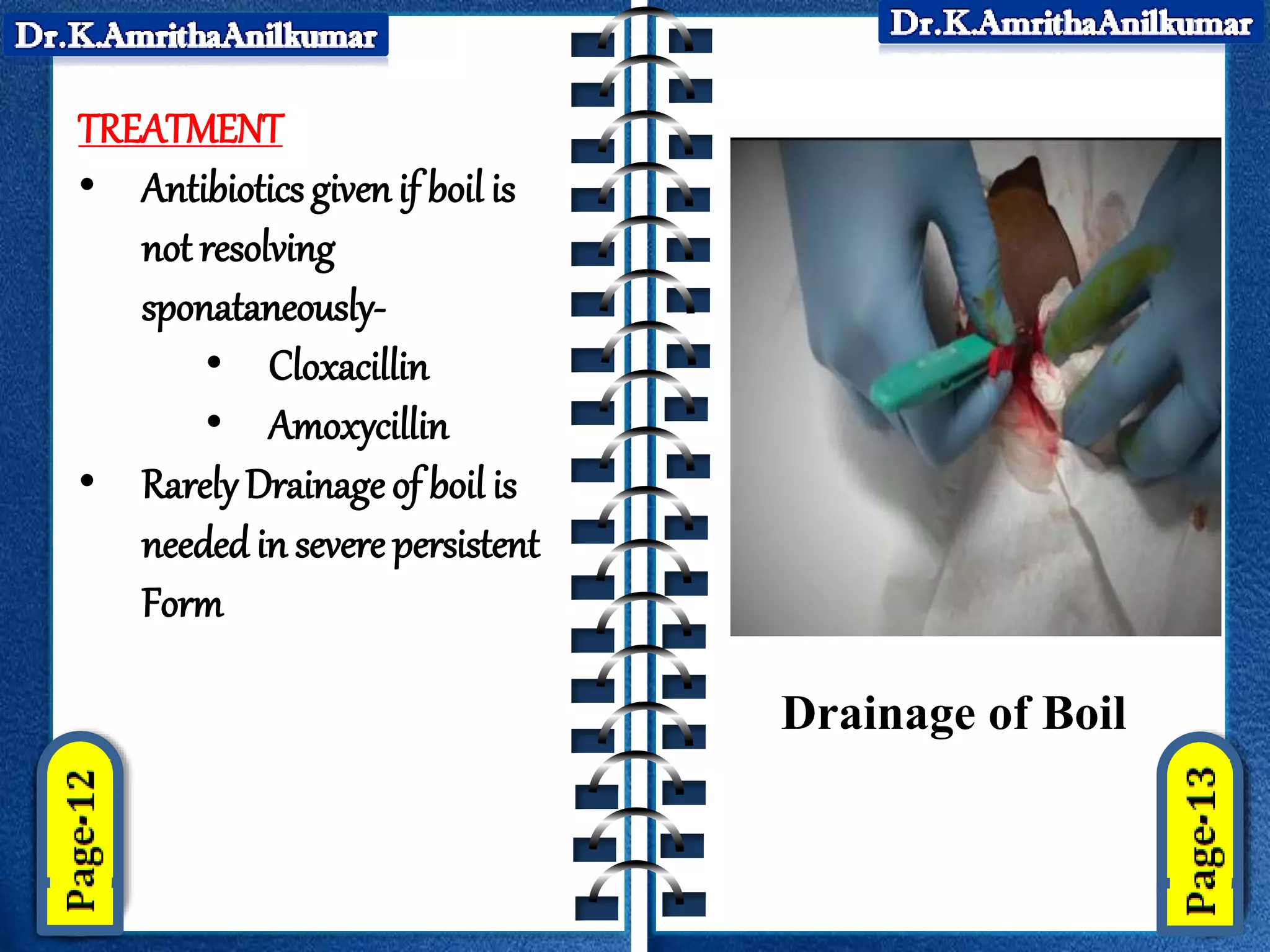 Boils or furuncle by Dr.K.AmrithaAnilkumar | PPTX