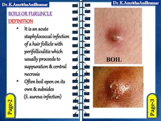 Boils or furuncle by Dr.K.AmrithaAnilkumar | PPTX