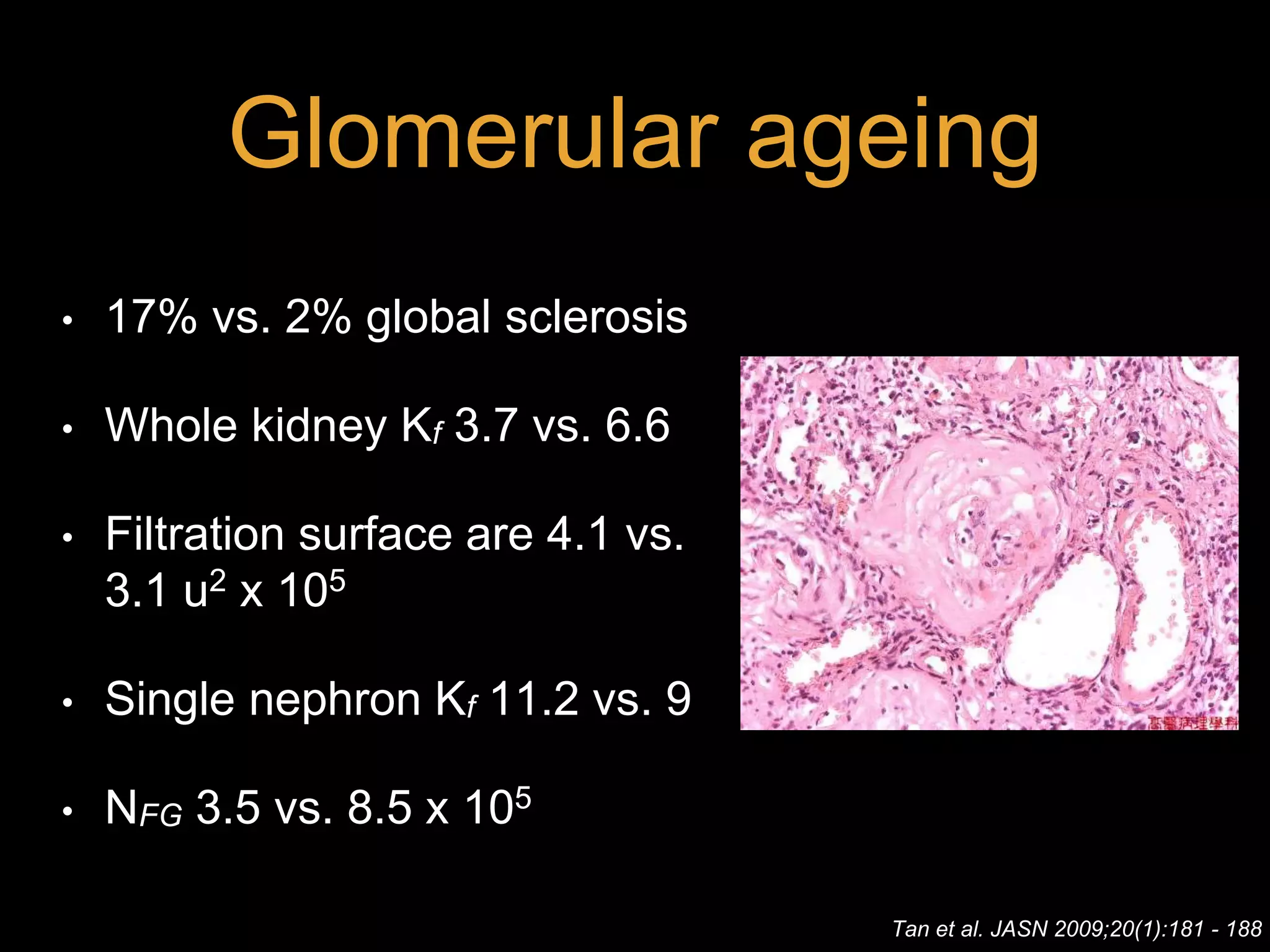 Chronic kidney disease and old age | PPTX