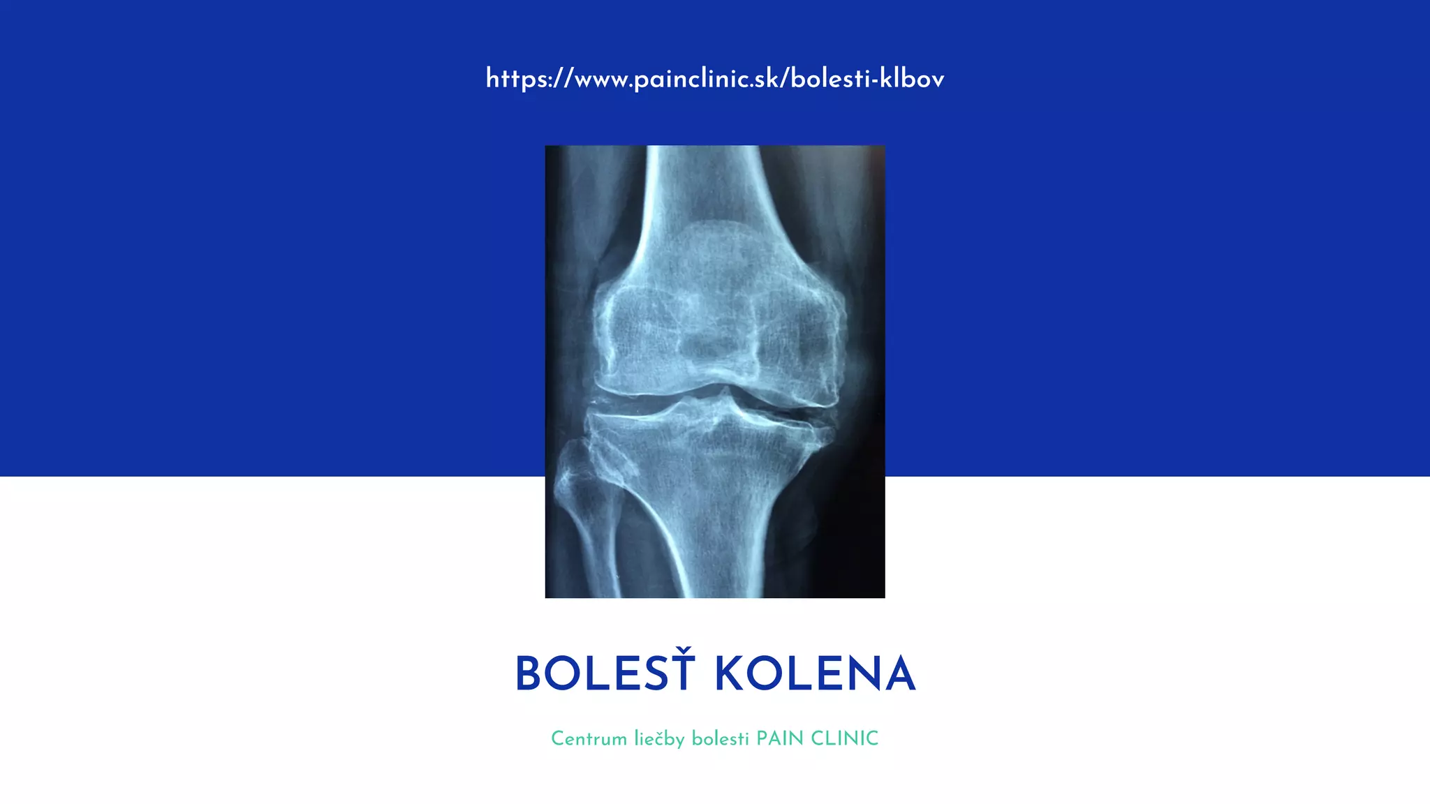 Bolest kolena | PDF