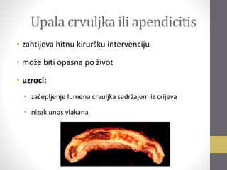Bolesti crijeva | PPTX