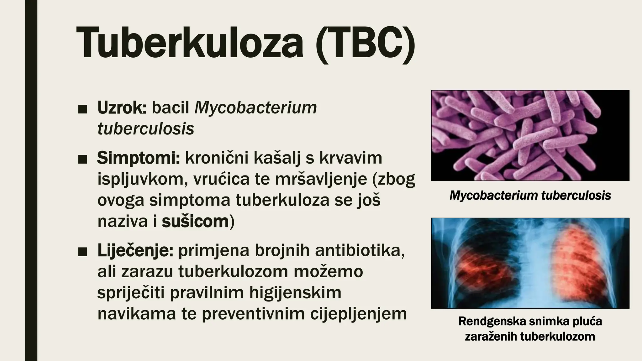 BOLESTI DIŠNOG SUSTAVA.pptx
