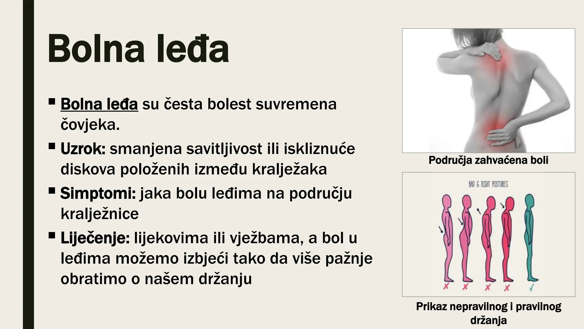 BOLESTI SUSTAVA ZA KRETANJE.pptx