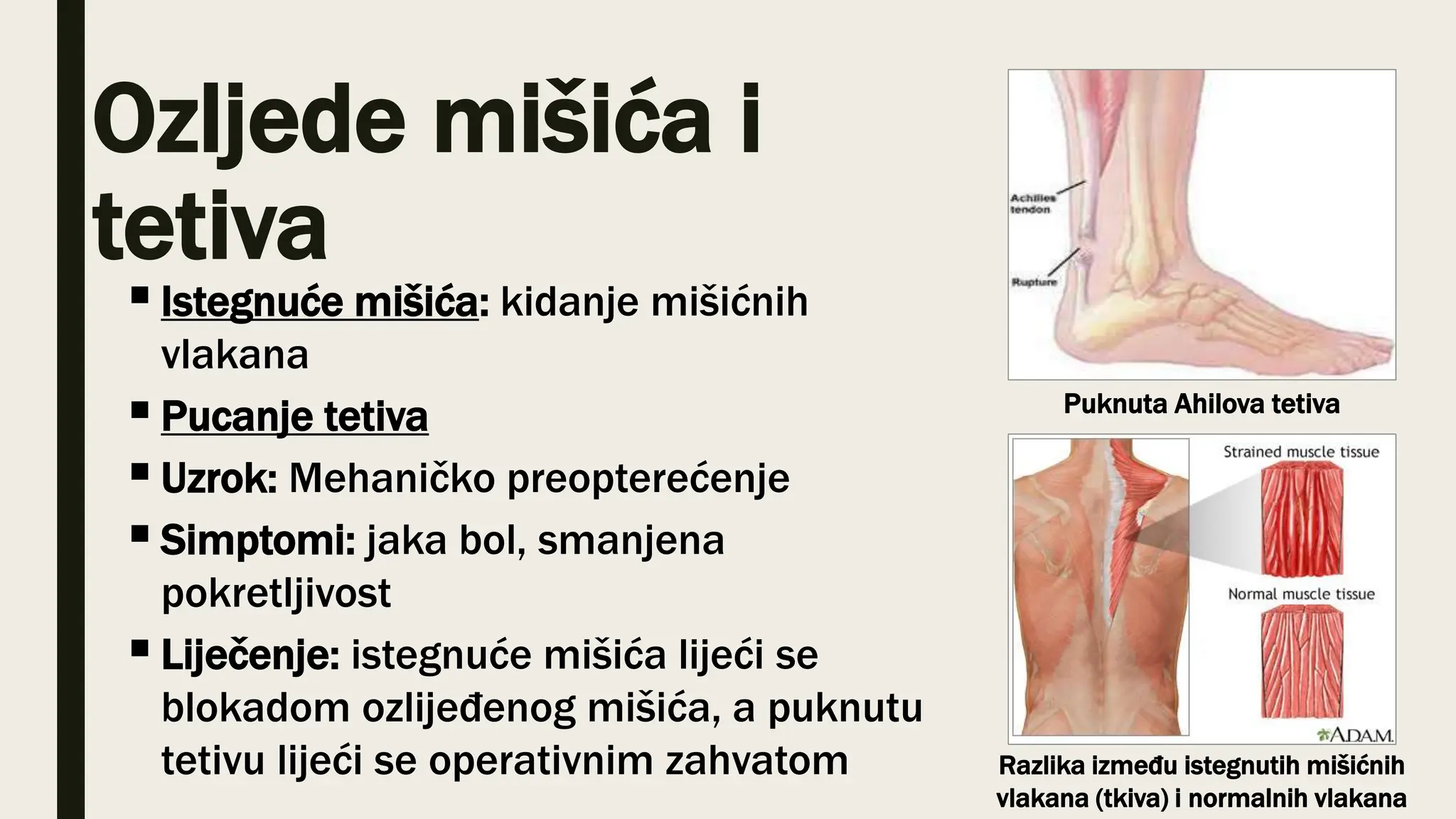 BOLESTI SUSTAVA ZA KRETANJE.pptx