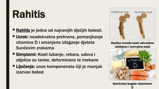 BOLESTI SUSTAVA ZA KRETANJE.pptx