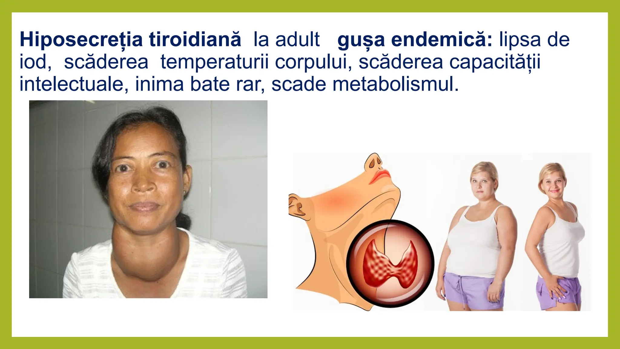 boli_endocrine.pdf........................ | PPT