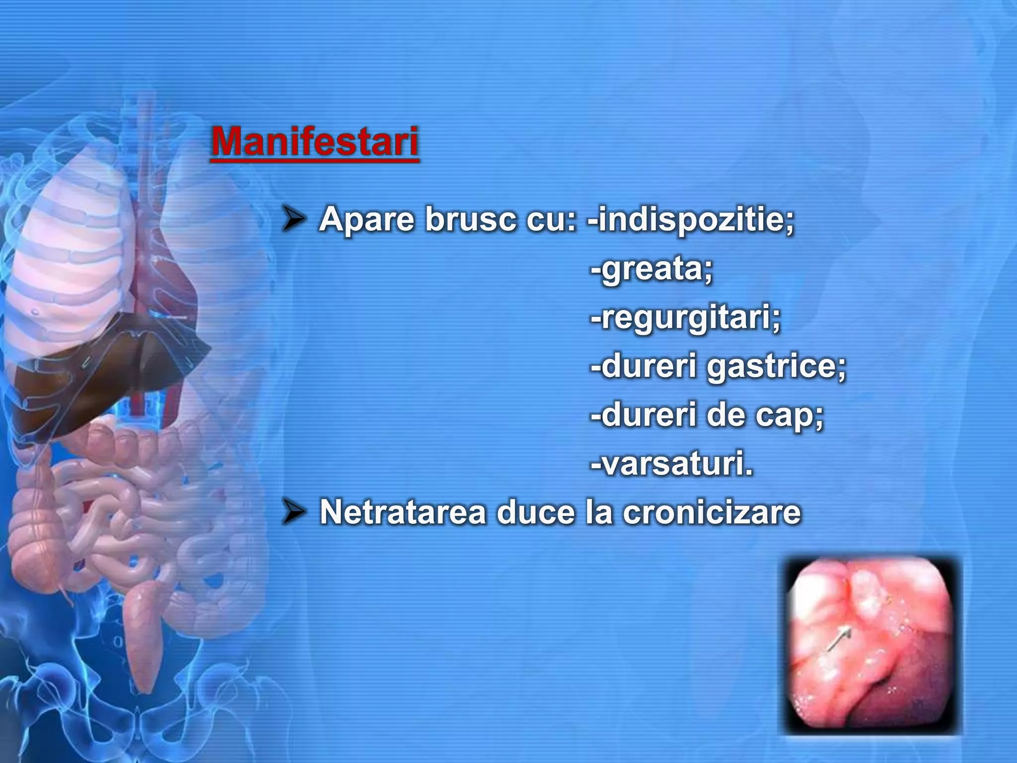 Bolile sistemului digestiv la om.pptx
