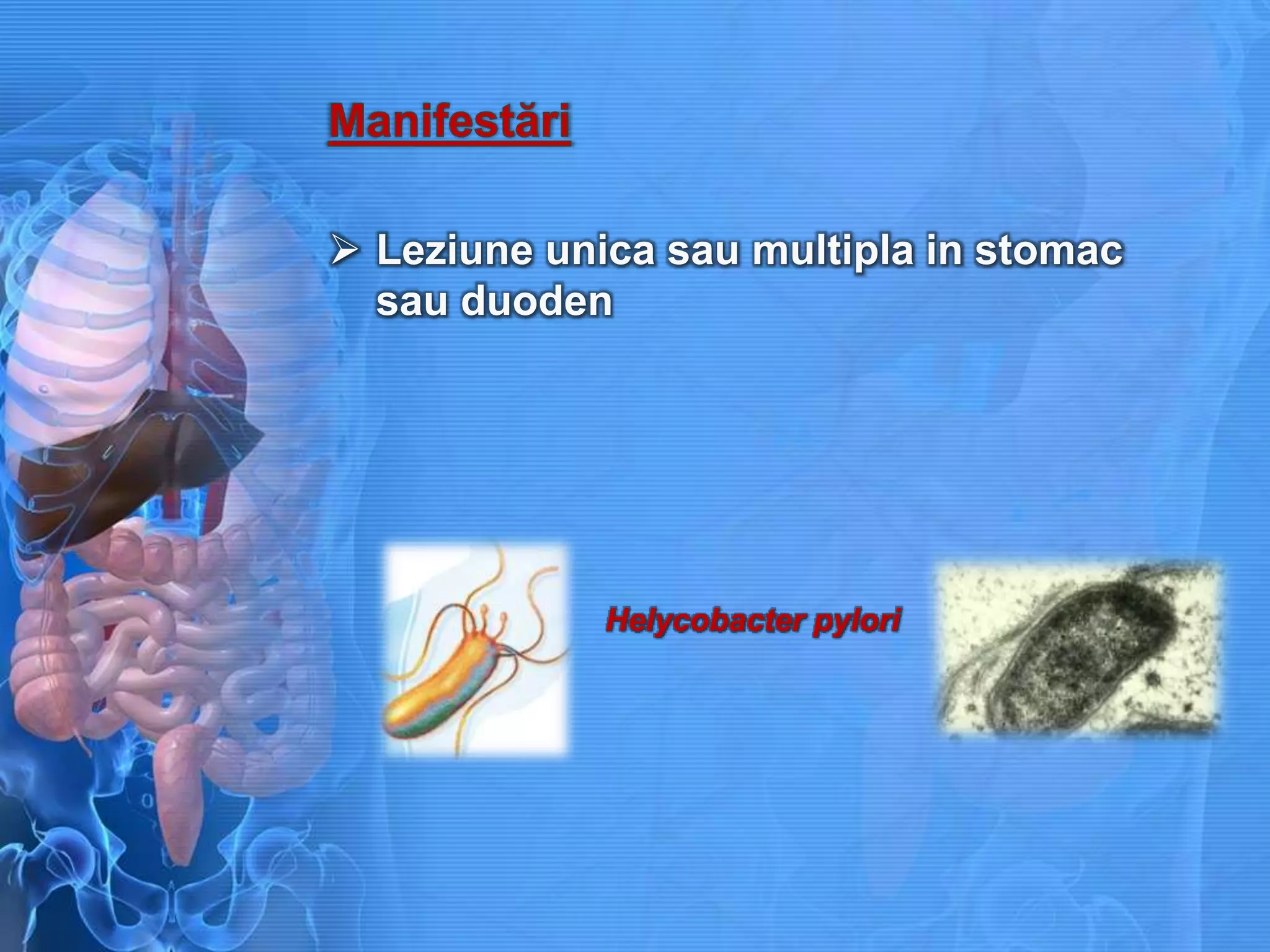 Bolile sistemului digestiv la om.pptx