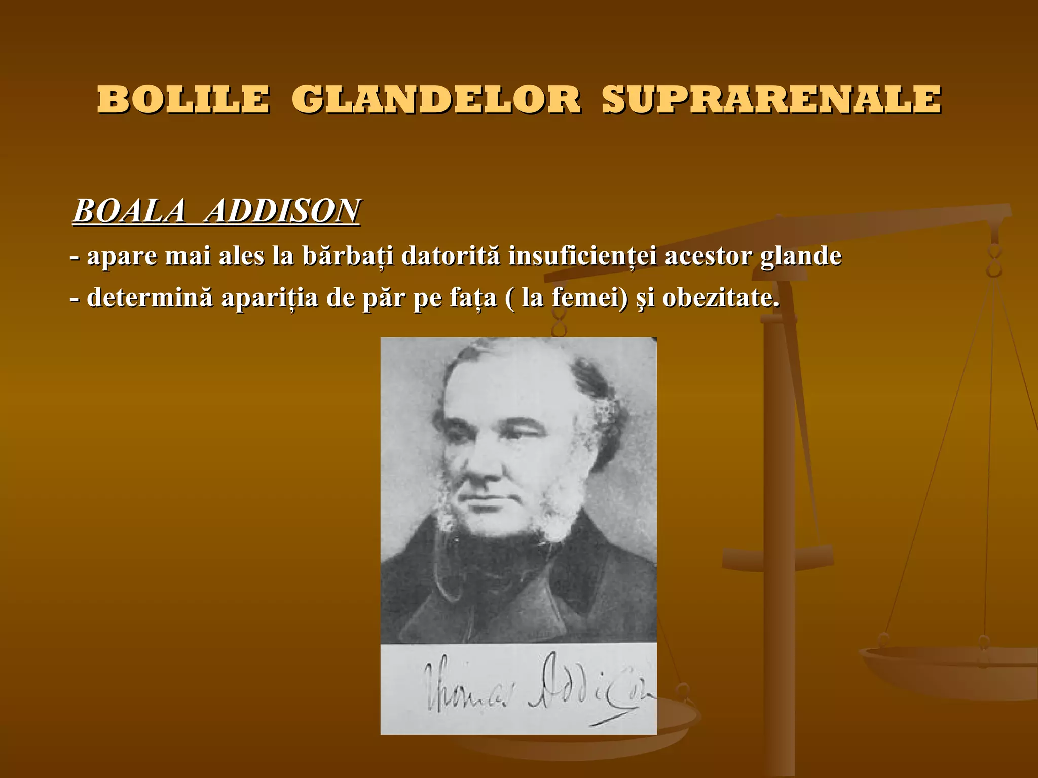 Bolilesistemuluiendocrin | PPT