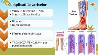 Bolile venelor | PPT | Free Download