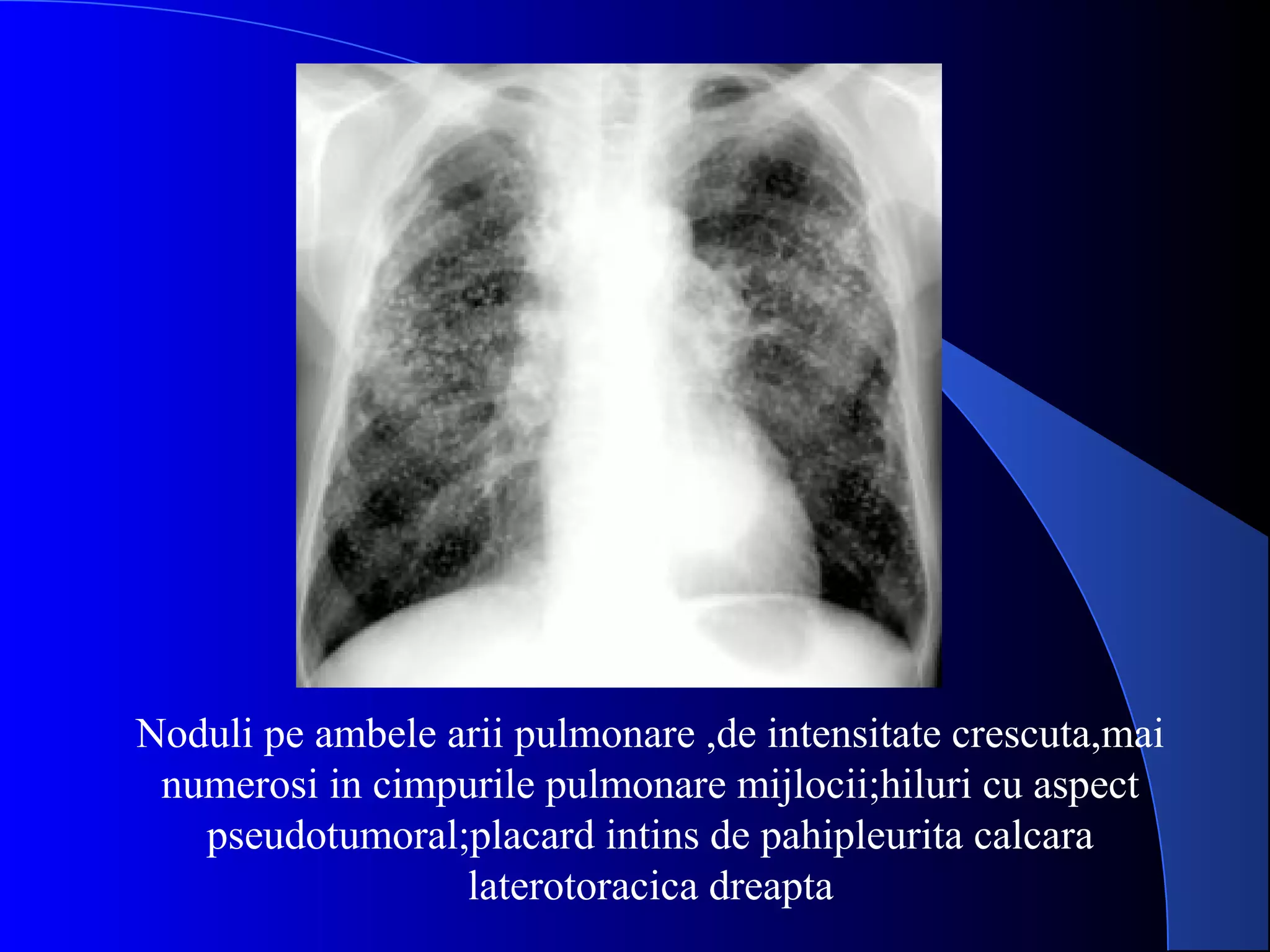 Boli profesionale | PPT