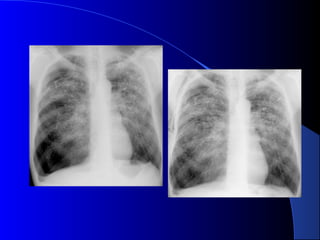 Boli profesionale | PPT