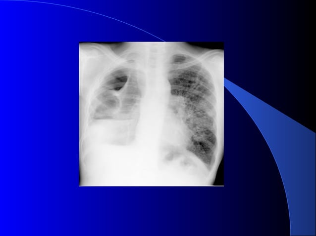 Boli profesionale | PPT