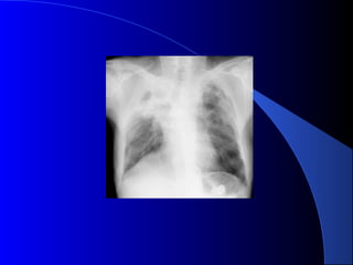 Boli profesionale | PPT