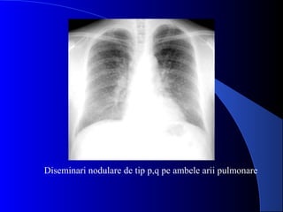 Boli profesionale | PPT