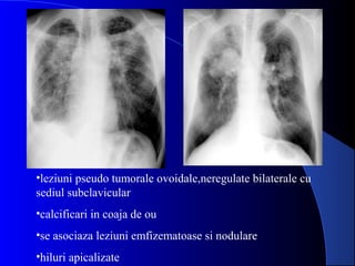 Boli profesionale | PPT