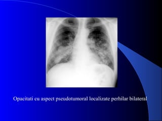 Boli profesionale | PPT