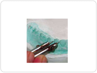 Bolton analysis and mixed dentition analysis | PPTX