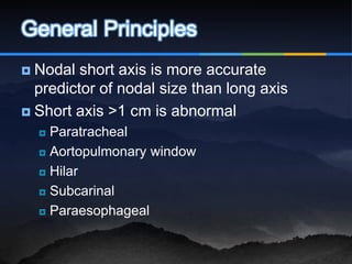 diagnostic workup of the the thoracic surgery patient | PPTX
