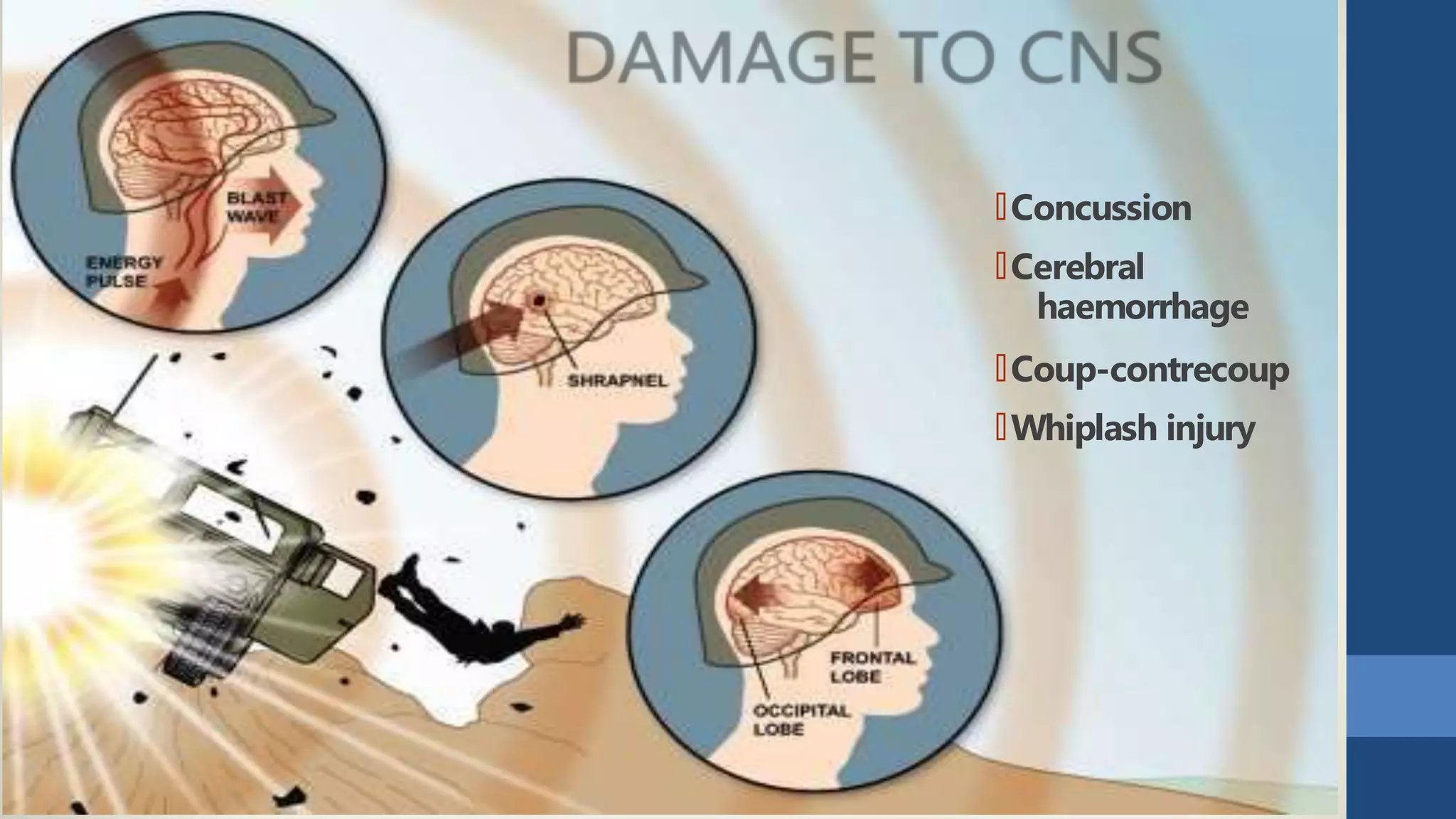 BOMB BLAST INJURIES.pptx