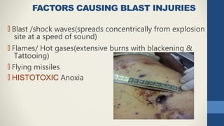 BOMB BLAST INJURIES.pptx