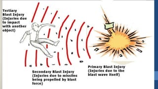 BOMB BLAST INJURIES.pptx