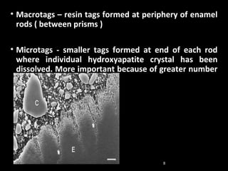 Bond | PPT
