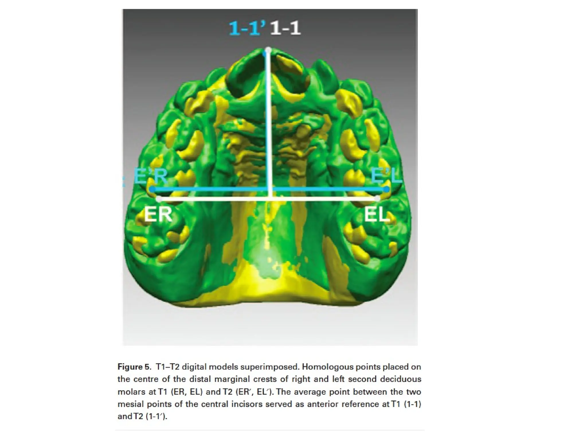 bonded vs banded expansion.pptx dfgtnhrtthertg | PPTX