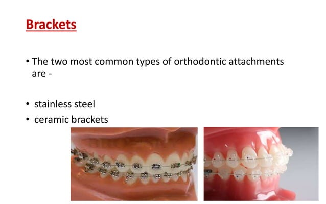 BONDING in orthodontics techniques .pptx | Dental Health | Diseases and ...