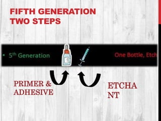Dentin Bonding agents generations | PPTX
