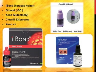 Dentin Bonding agents generations | PPTX